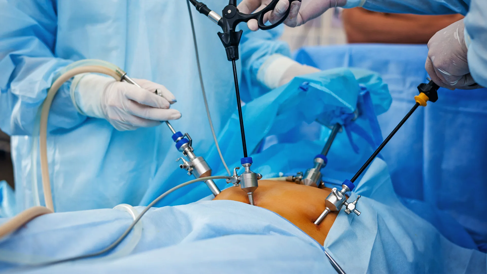 Laparoscopy • 3rd Park Hospital