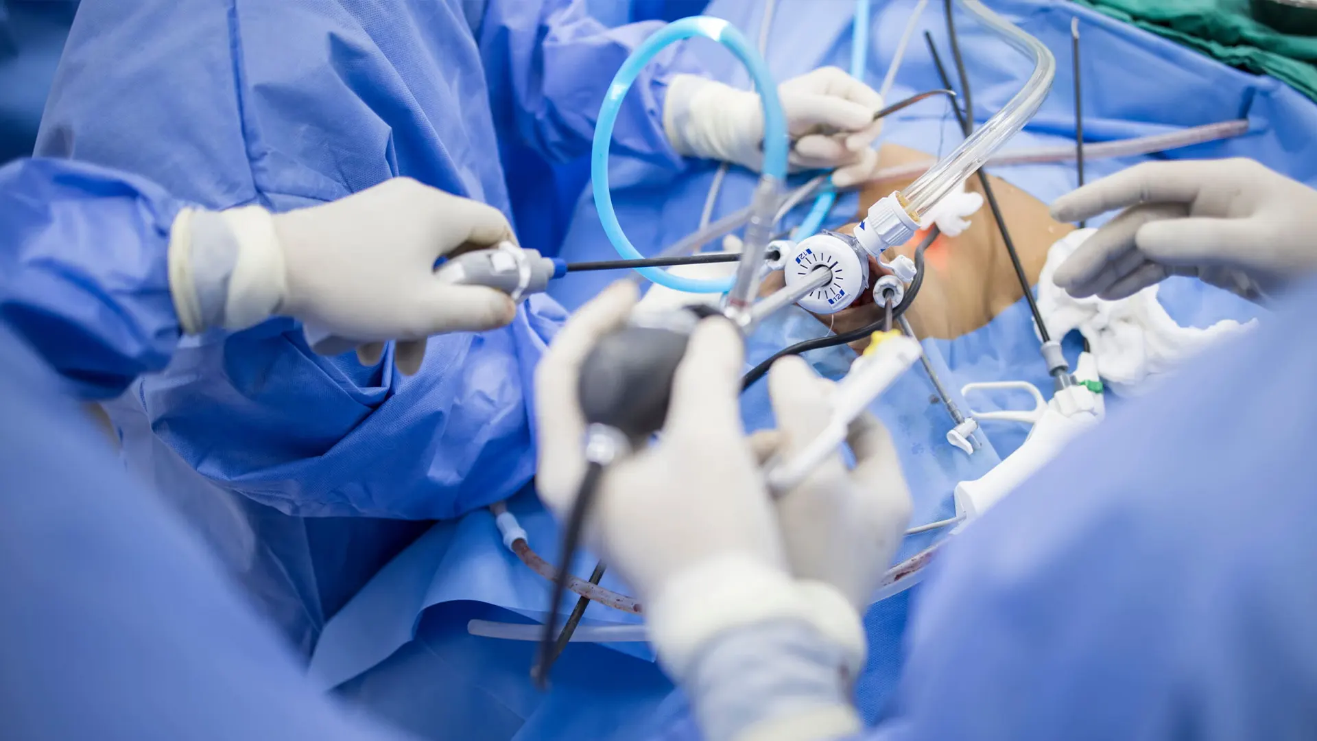 Laparoscopic Hysterectomy Laparoscopic Vs Vaginal Hysterectomy: 5